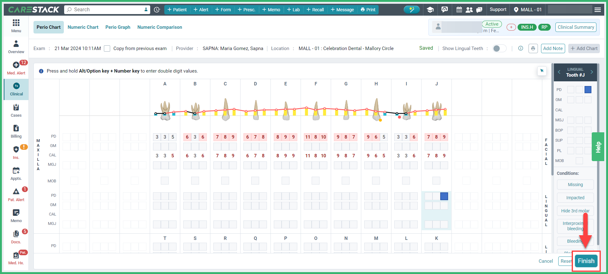 An Overview of the Perio Chart – CareStack: User Resource Center
