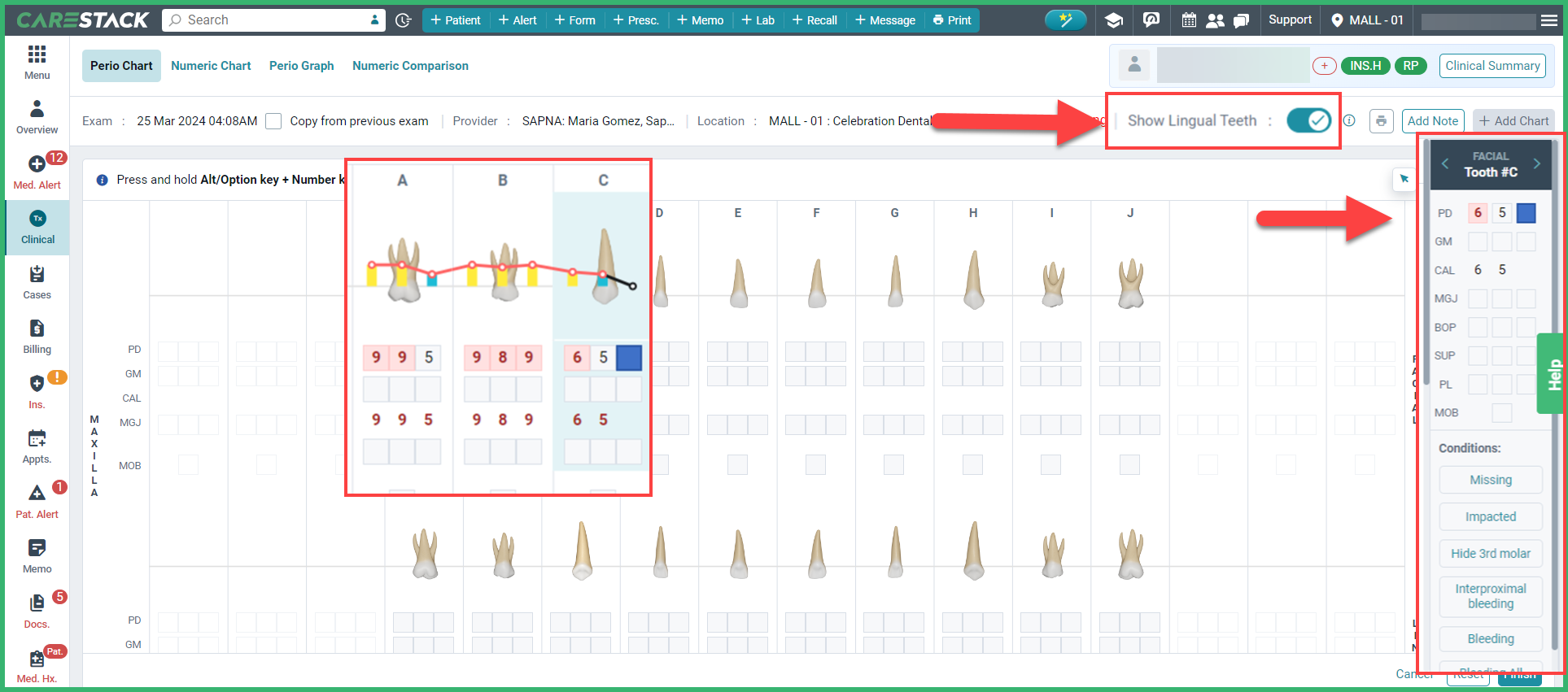An Overview of the Perio Chart – CareStack: User Resource Center