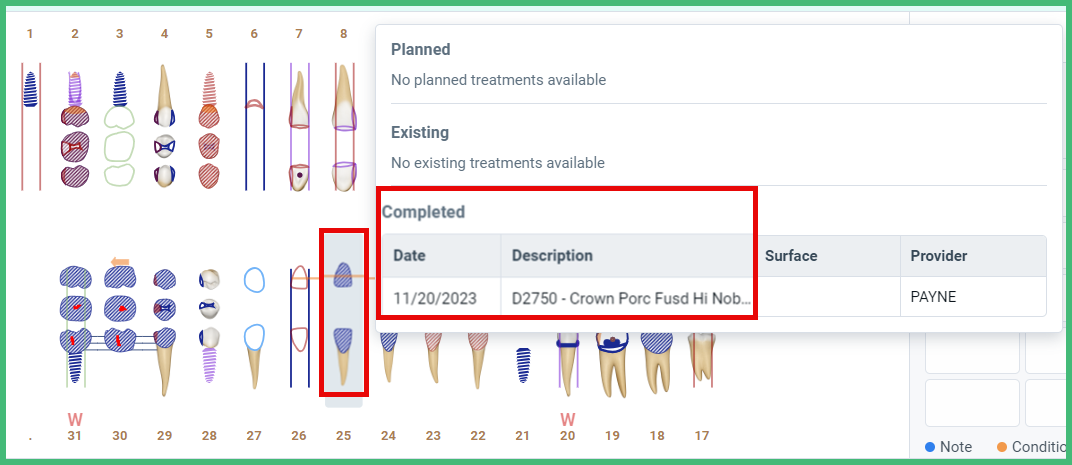 A Guide to the Odontogram – CareStack: User Resource Center