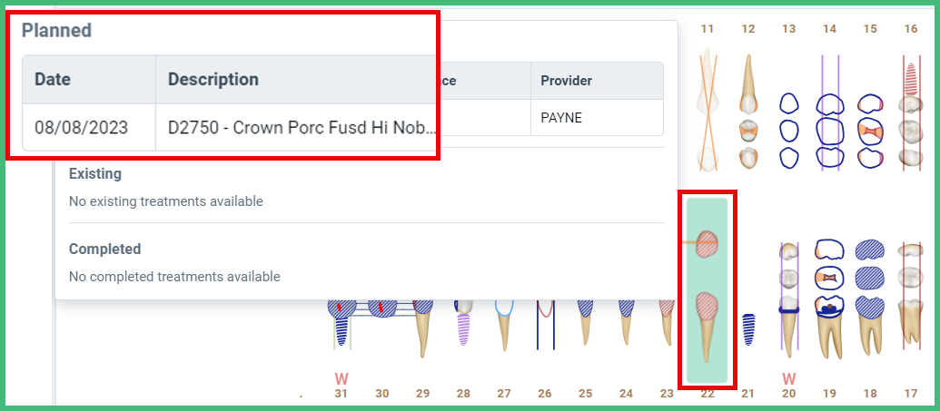 A Guide to the Odontogram – CareStack: User Resource Center