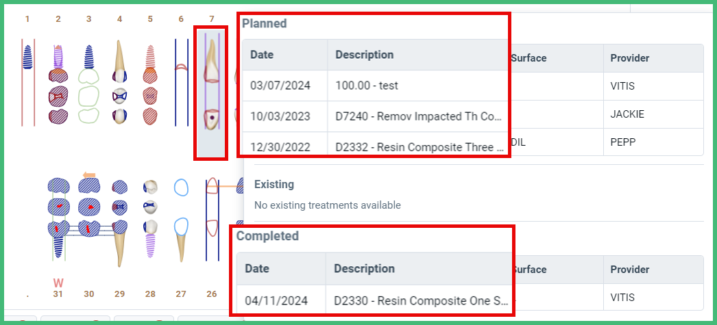 A Guide to the Odontogram – CareStack: User Resource Center