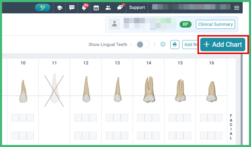 An Overview of the Perio Chart – CareStack: User Resource Center