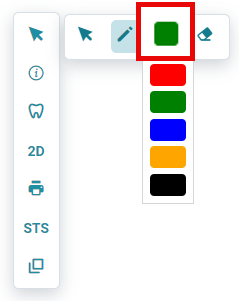 A Guide to the Odontogram – CareStack: User Resource Center