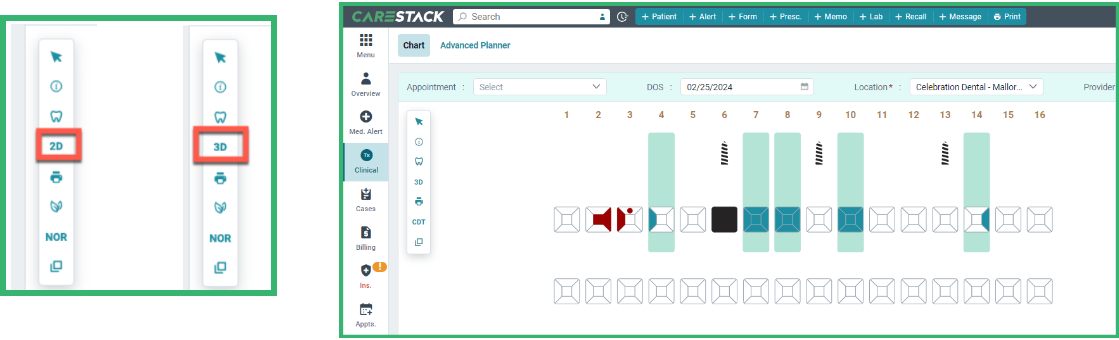 A Guide to the Odontogram (Charting) – CareStack