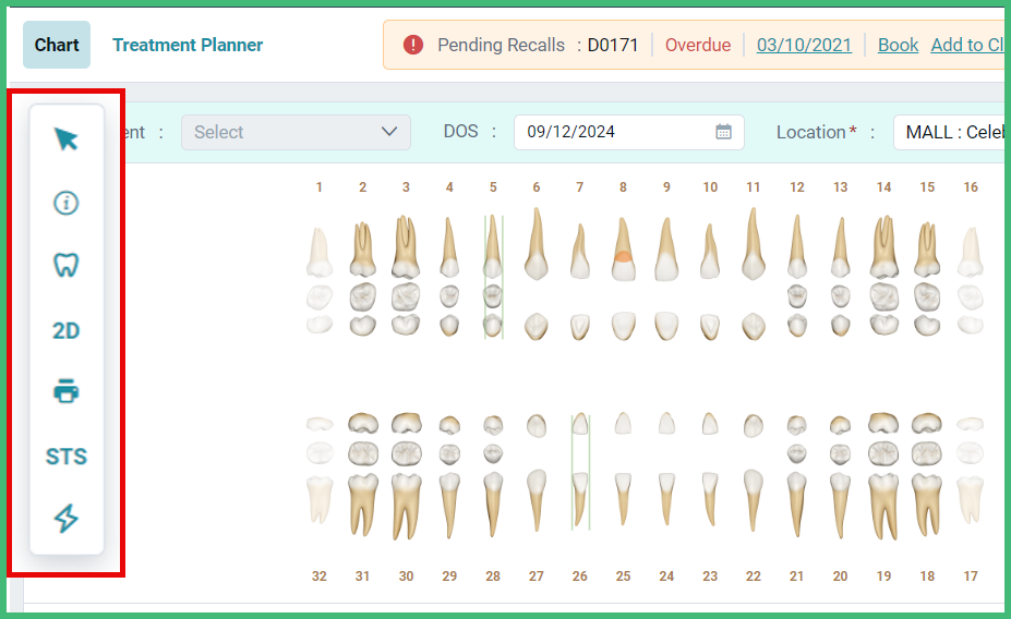 A Guide to the Odontogram – CareStack: User Resource Center