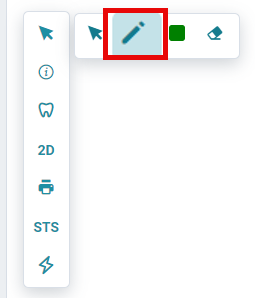 A Guide to the Odontogram (Charting) – CareStack
