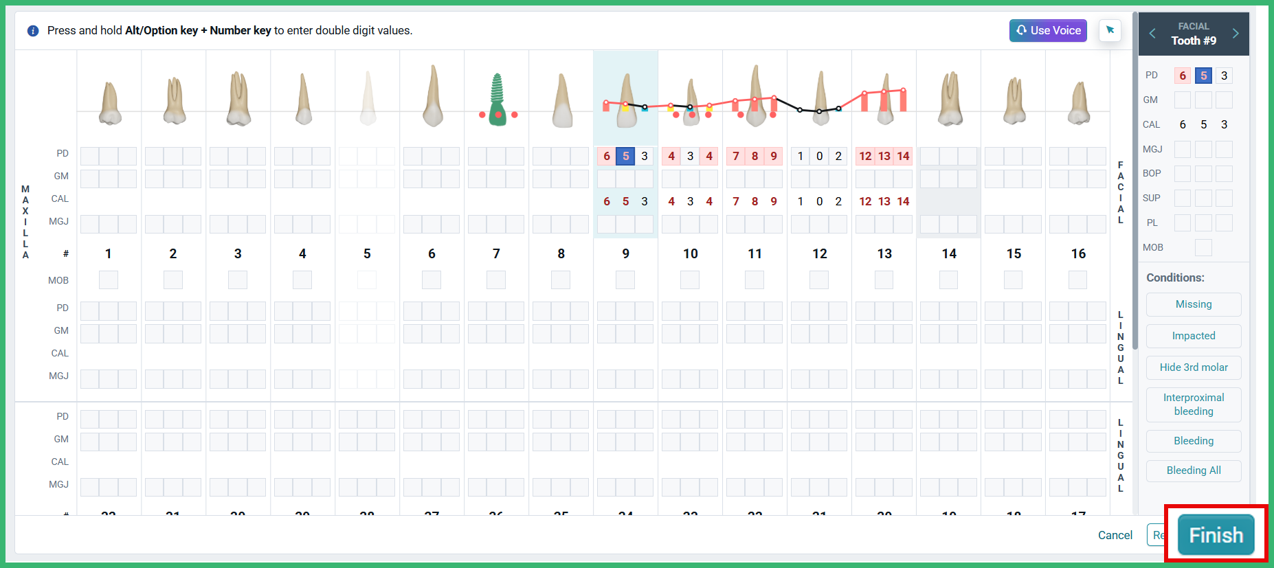 An Overview of the Perio Chart – CareStack: User Resource Center