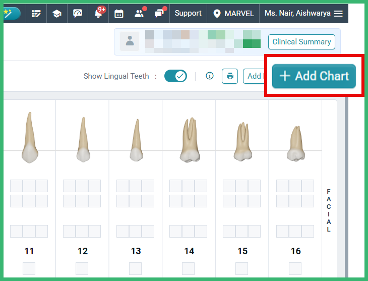 An Overview of the Perio Chart – CareStack: User Resource Center