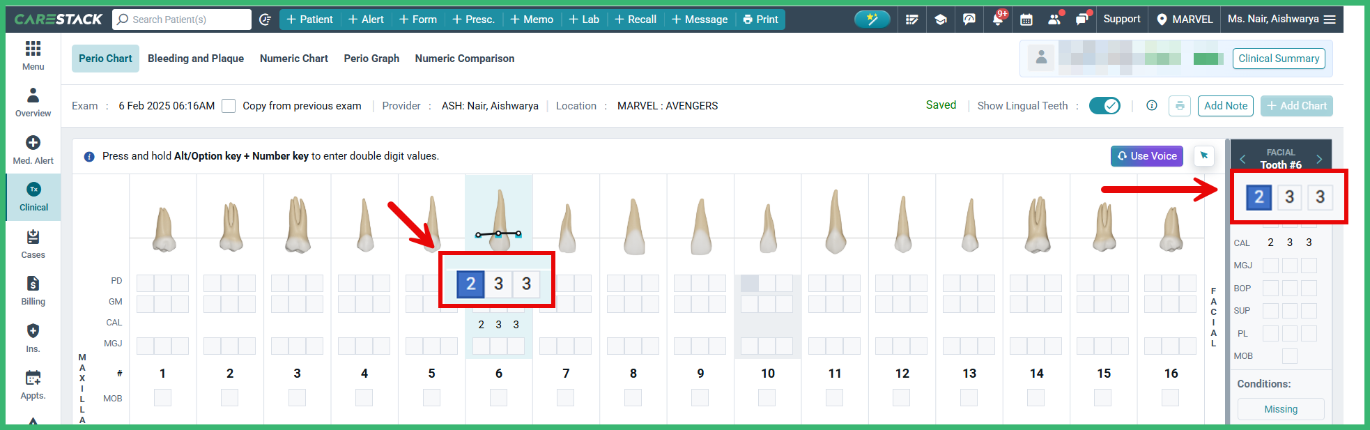 An Overview of the Perio Chart – CareStack: User Resource Center
