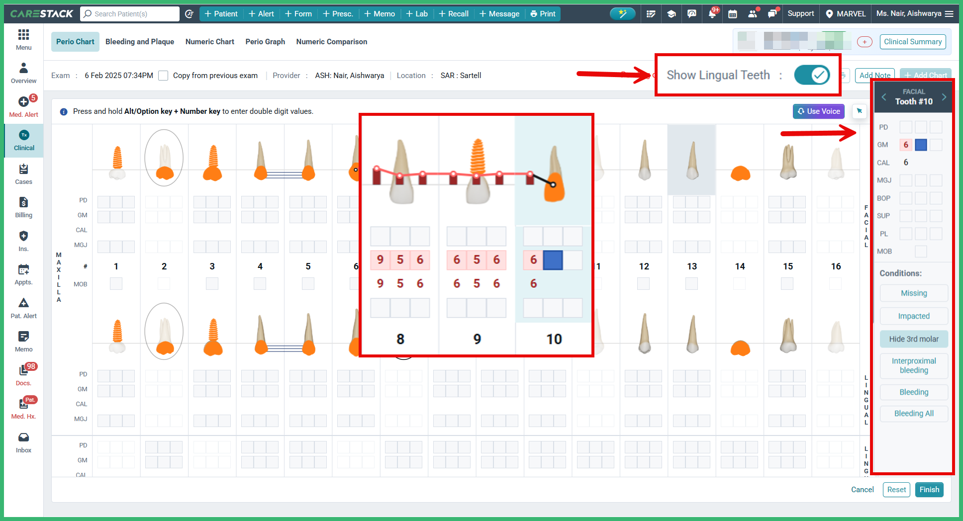 An Overview of the Perio Chart – CareStack: User Resource Center