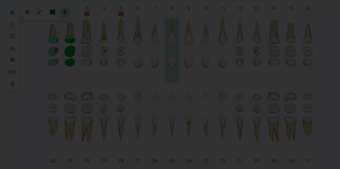 A Guide to the Odontogram – CareStack: User Resource Center