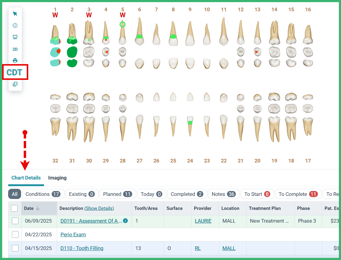 A Guide to the Odontogram – CareStack: User Resource Center