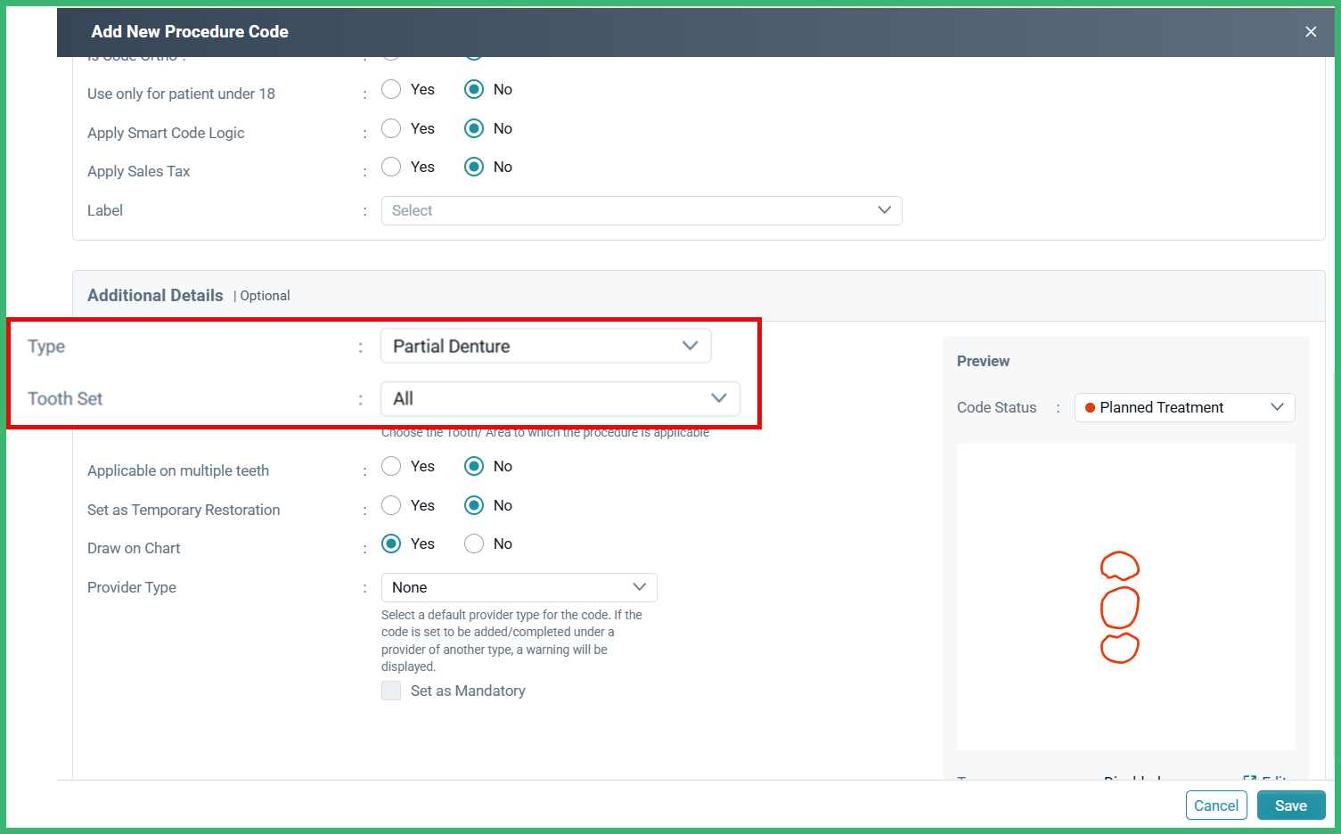 Add, View, and Edit Procedure Codes – CareStack: User Resource Center