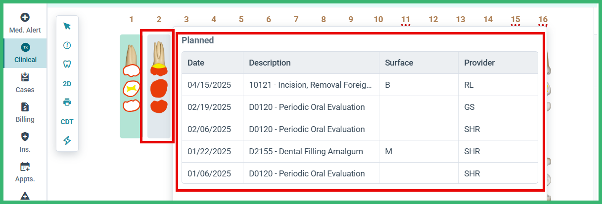 A Guide to the Odontogram – CareStack: User Resource Center