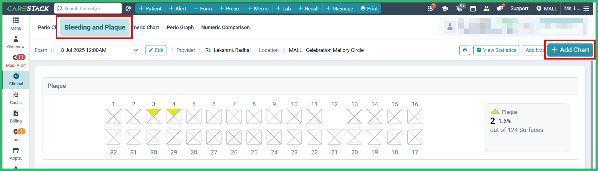Add Plaque and Bleeding to the Perio Chart – CareStack: User Resource ...
