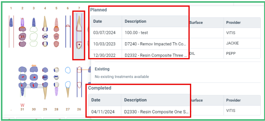 A Guide to the Odontogram – CareStack: User Resource Center