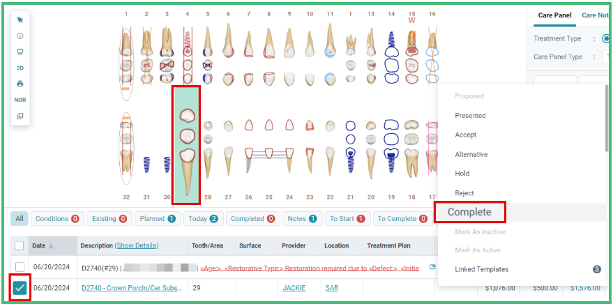 A Guide to the Odontogram – CareStack: User Resource Center