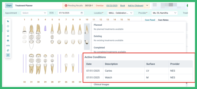 A Guide to the Odontogram – CareStack: User Resource Center