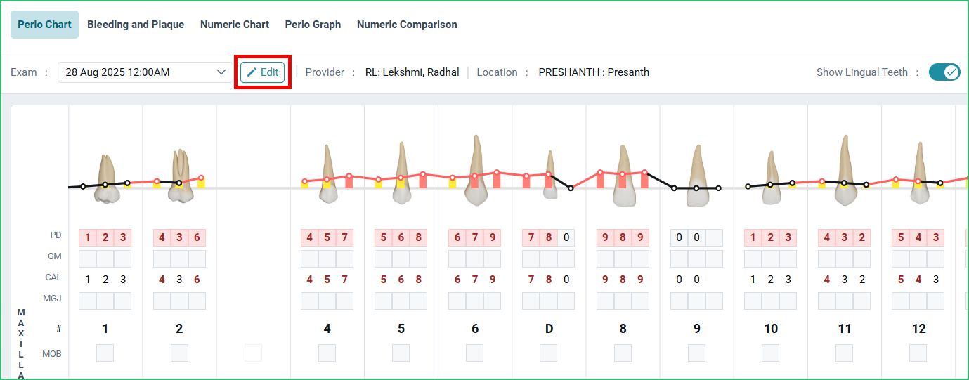 Explore Perio Charting – CareStack: User Resource Center