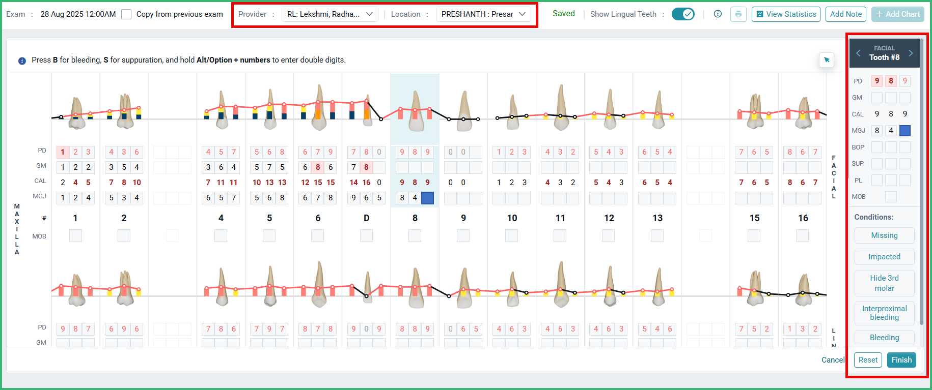 Explore Perio Charting – CareStack: User Resource Center