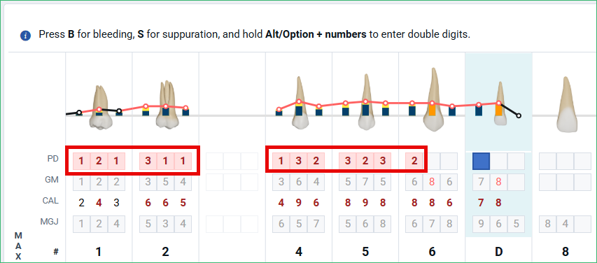 Explore Perio Charting – CareStack: User Resource Center