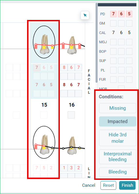 Explore Perio Charting – CareStack: User Resource Center