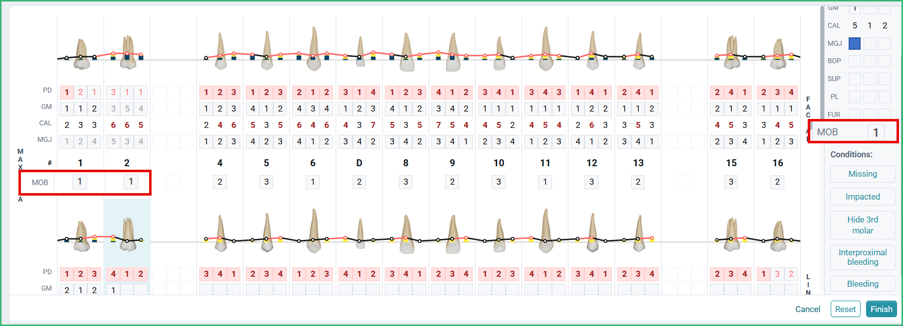 Explore Perio Charting – CareStack: User Resource Center
