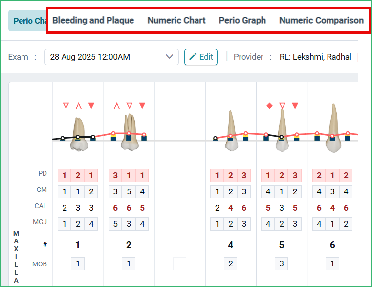 Explore Perio Charting – CareStack: User Resource Center