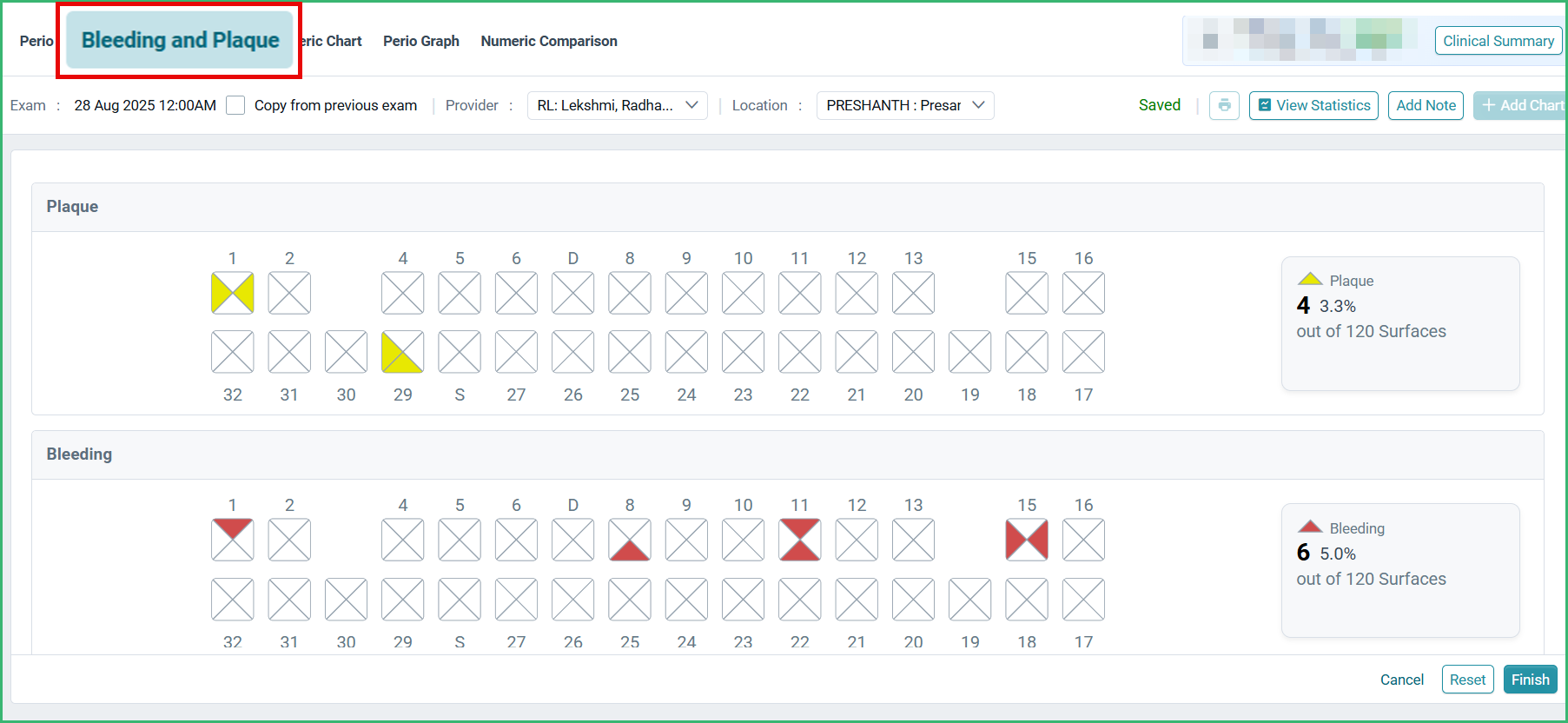 Explore Perio Charting – CareStack: User Resource Center