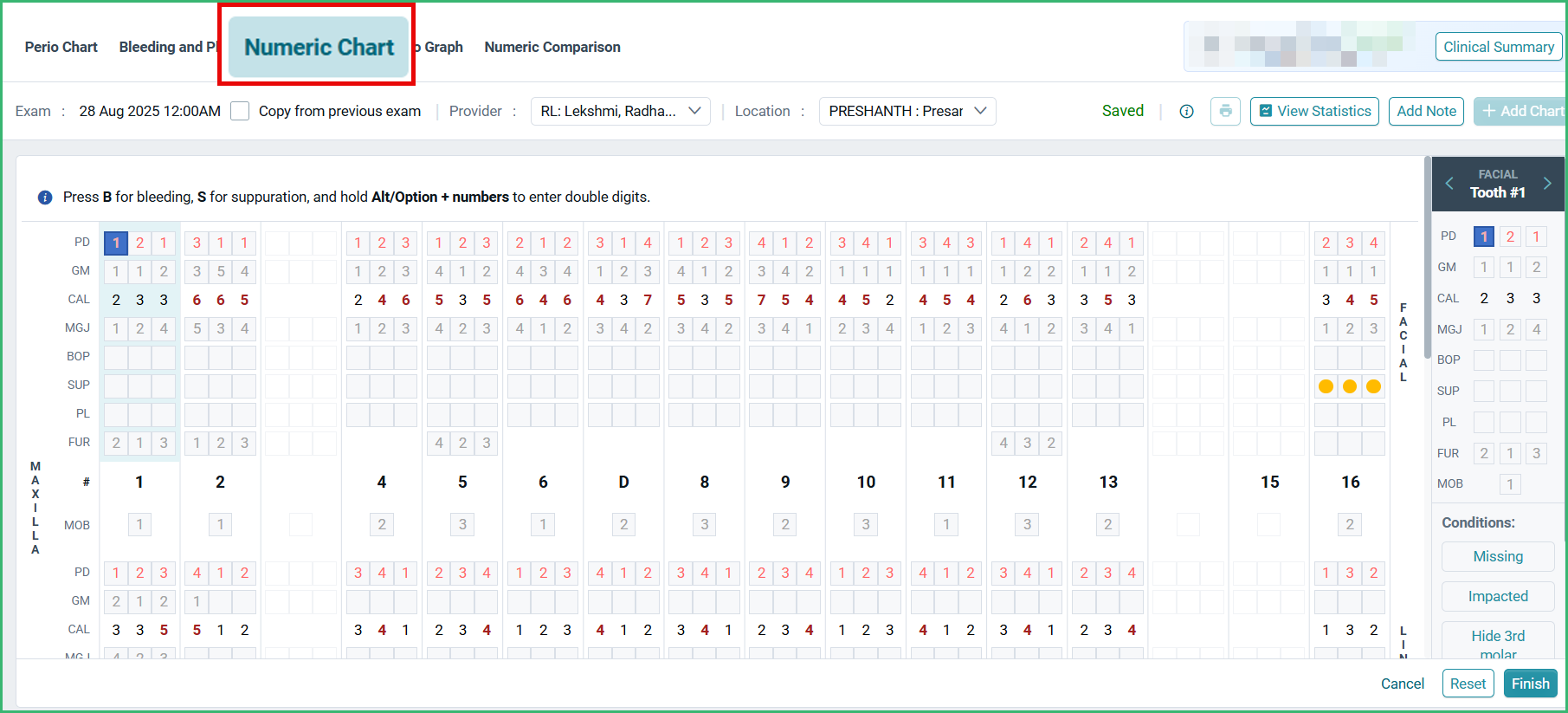 Explore Perio Charting – CareStack: User Resource Center