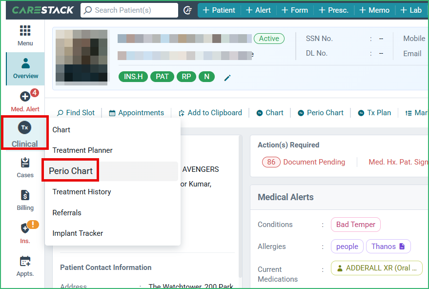 Explore Perio Charting – CareStack: User Resource Center