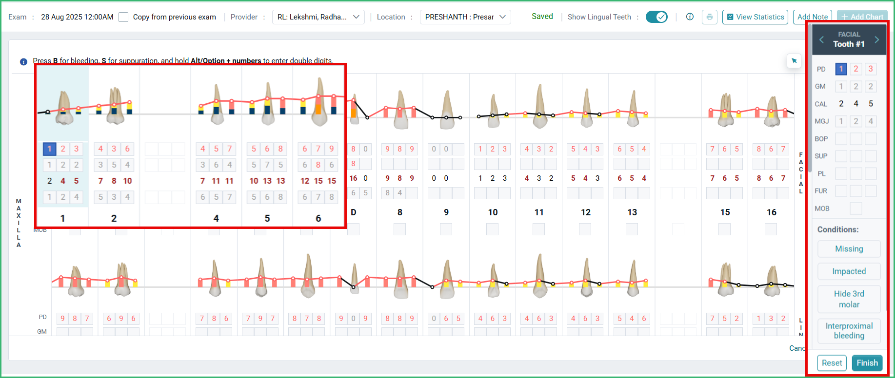 Explore Perio Charting – CareStack: User Resource Center