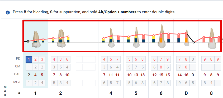 Explore Perio Charting – CareStack: User Resource Center