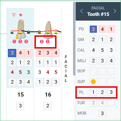 Explore Perio Charting – CareStack: User Resource Center