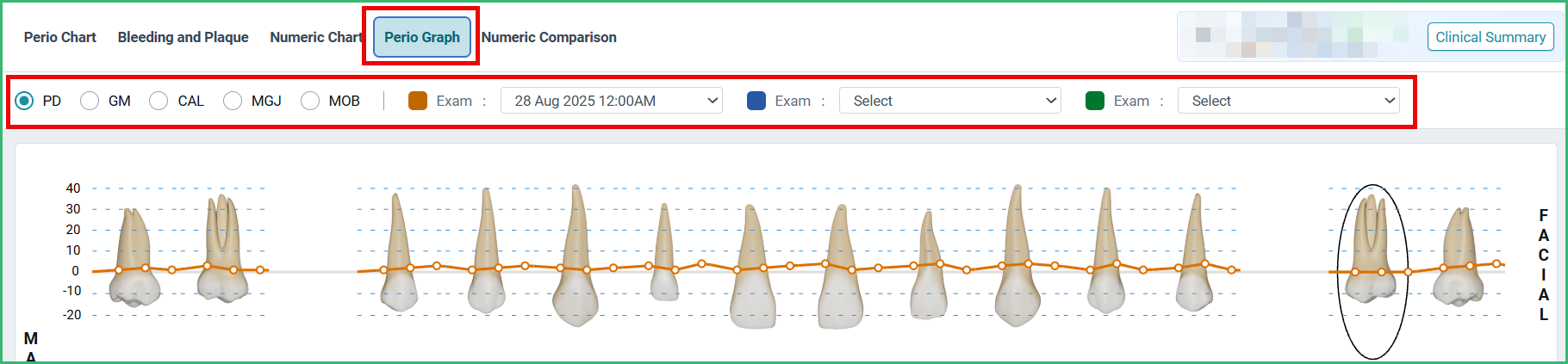Explore Perio Charting – CareStack: User Resource Center