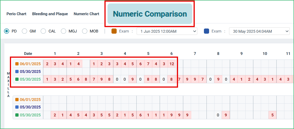 Explore Perio Charting – CareStack: User Resource Center