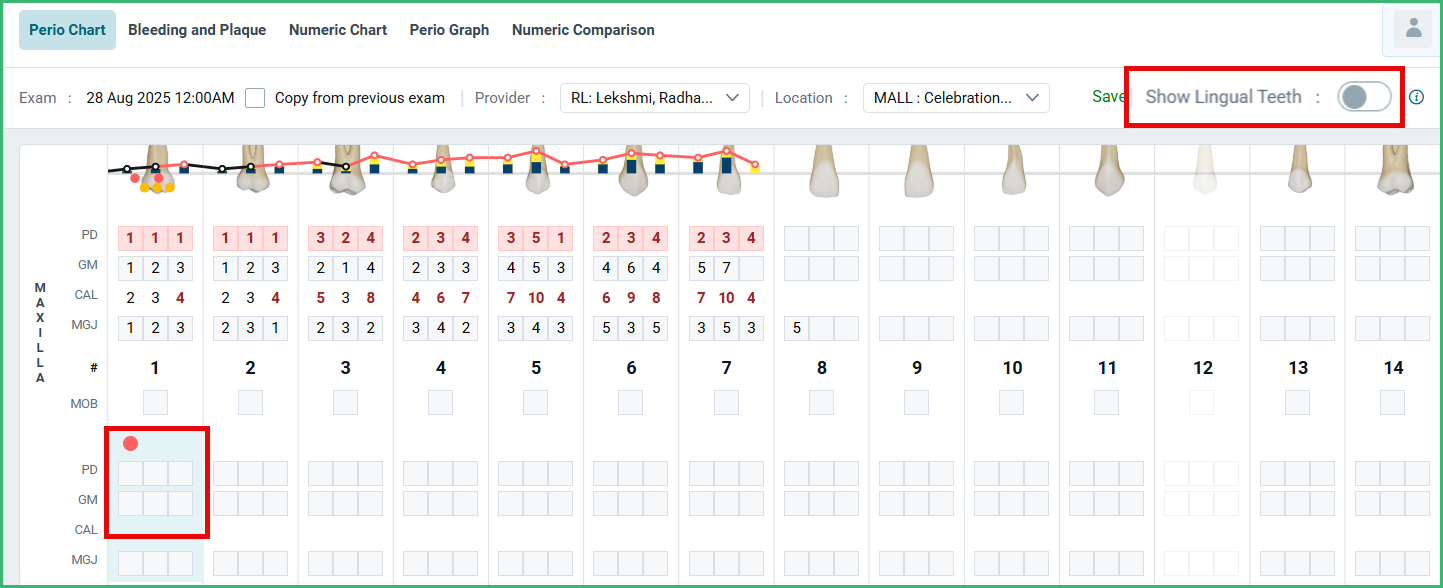 An Overview of the Perio Chart – CareStack: User Resource Center