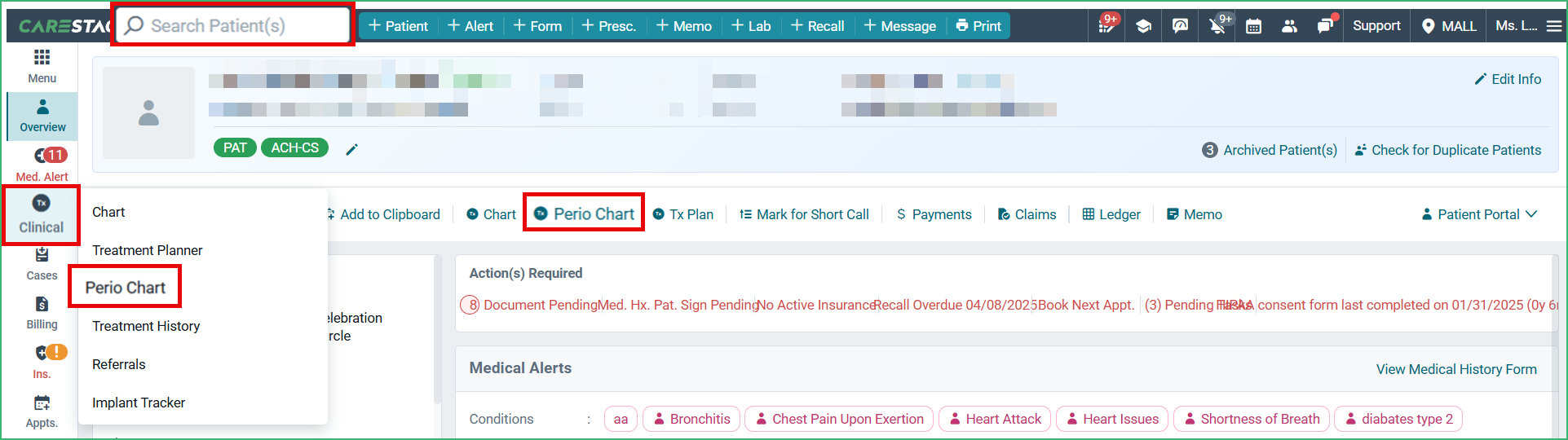 An Overview of the Perio Chart – CareStack: User Resource Center