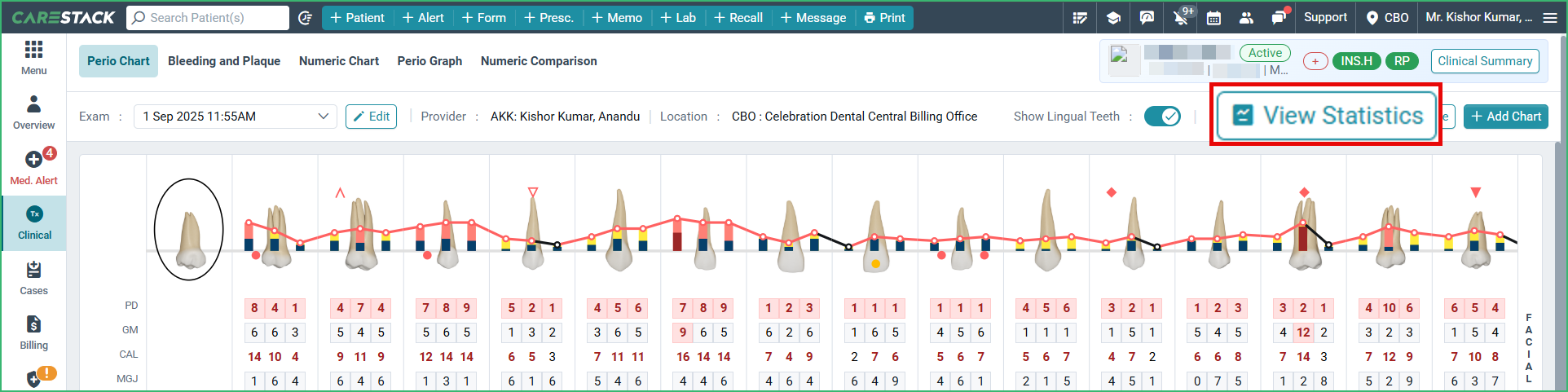 View Statistics in Perio Chart – CareStack: User Resource Center
