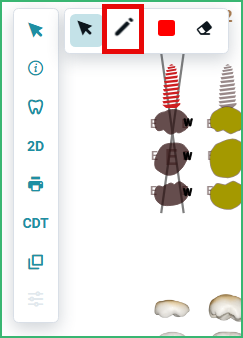A Guide to the Odontogram – CareStack: User Resource Center