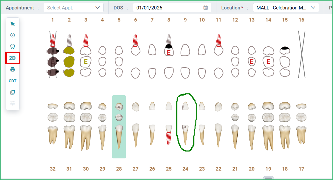A Guide to the Odontogram – CareStack: User Resource Center