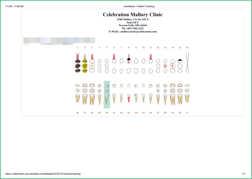 A Guide to the Odontogram – CareStack: User Resource Center