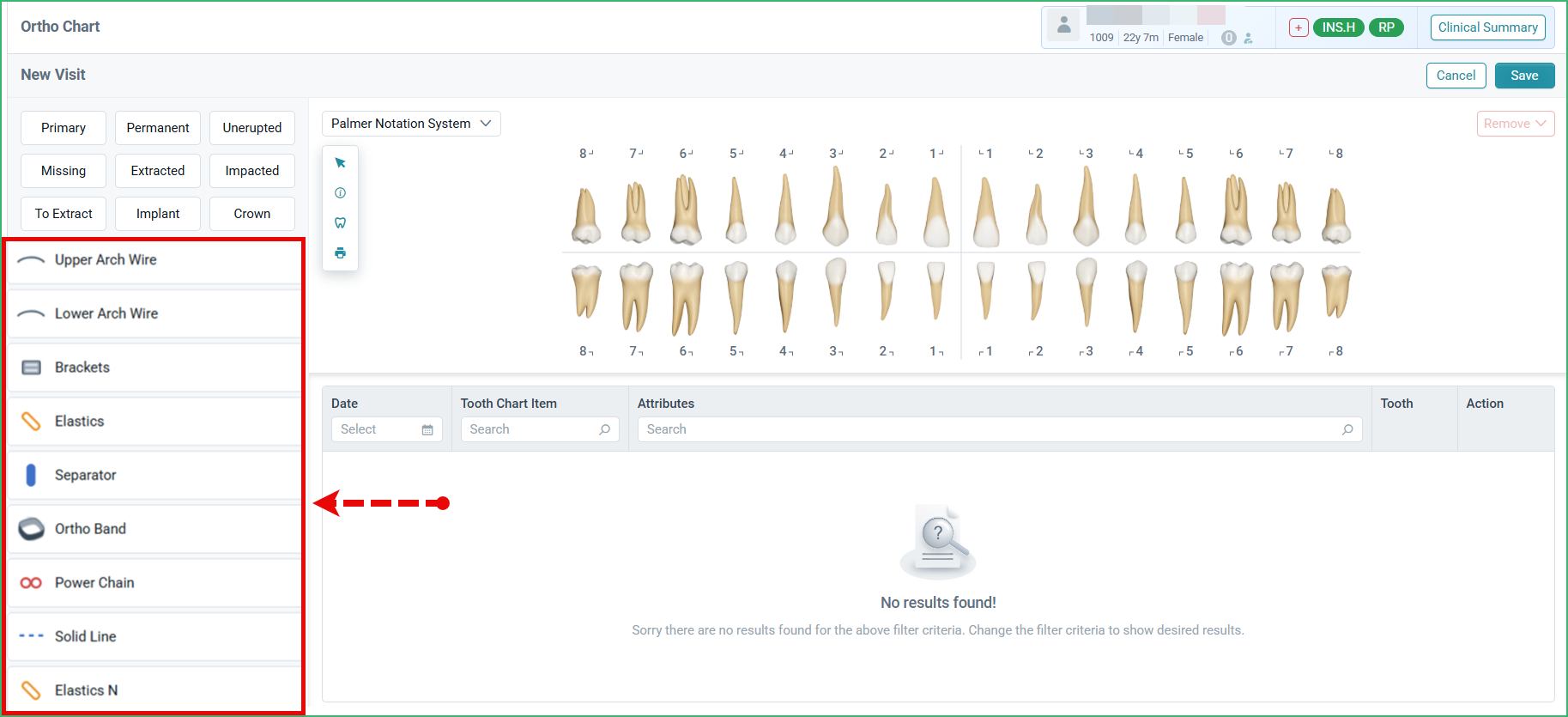 Explore and Manage Ortho Charting – CareStack: User Resource Center